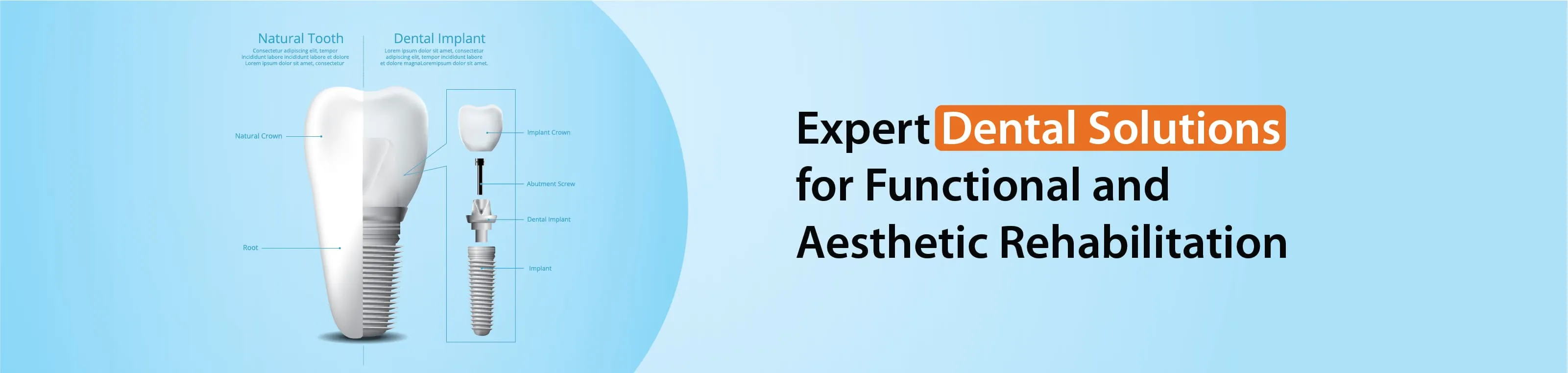 Best Dental Clinic in India | Apollo Dental